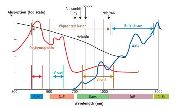 News - What Is A Long Pulsed Nd:YAG Laser?