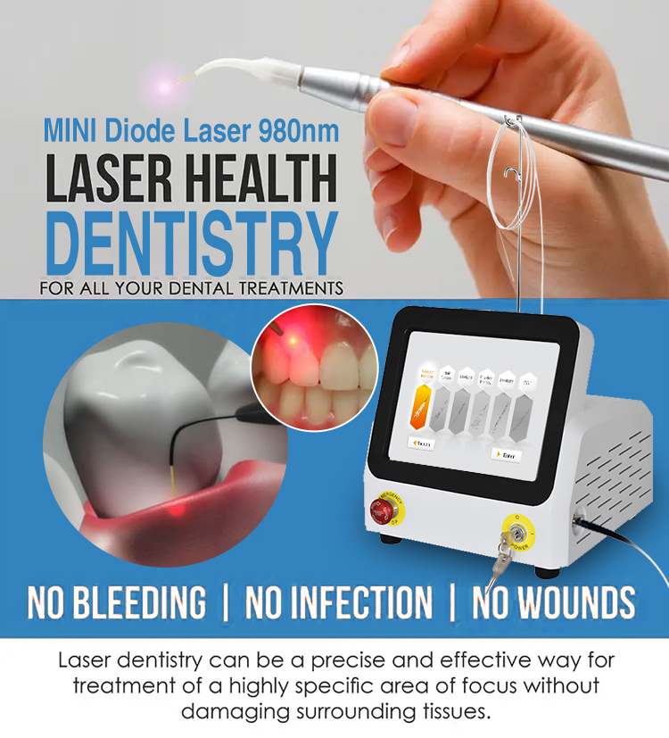 News - How About Diode Laser Treatment For Dental?
