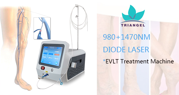 China Advanced Diode Lasers for Varicose Veins Treatment – 980nm ...