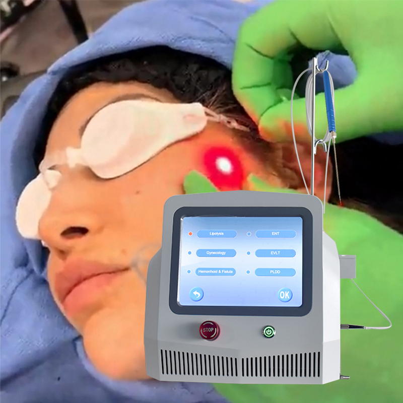 China Medical Aesthetic Devices Diodo Endolaser 980nm 1470nm LASEEV PRO ...