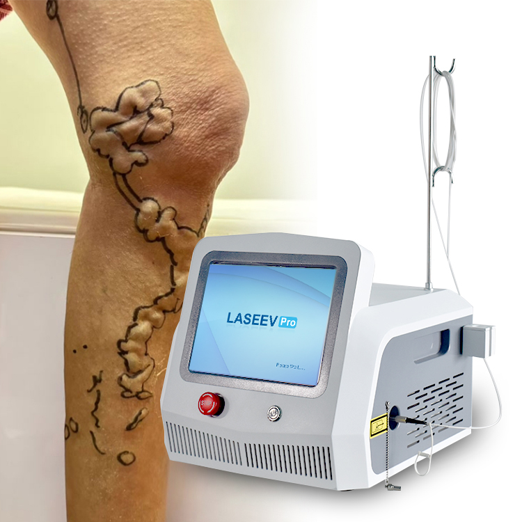 China Advanced Diode Lasers for Varicose Veins Treatment – 980nm ...